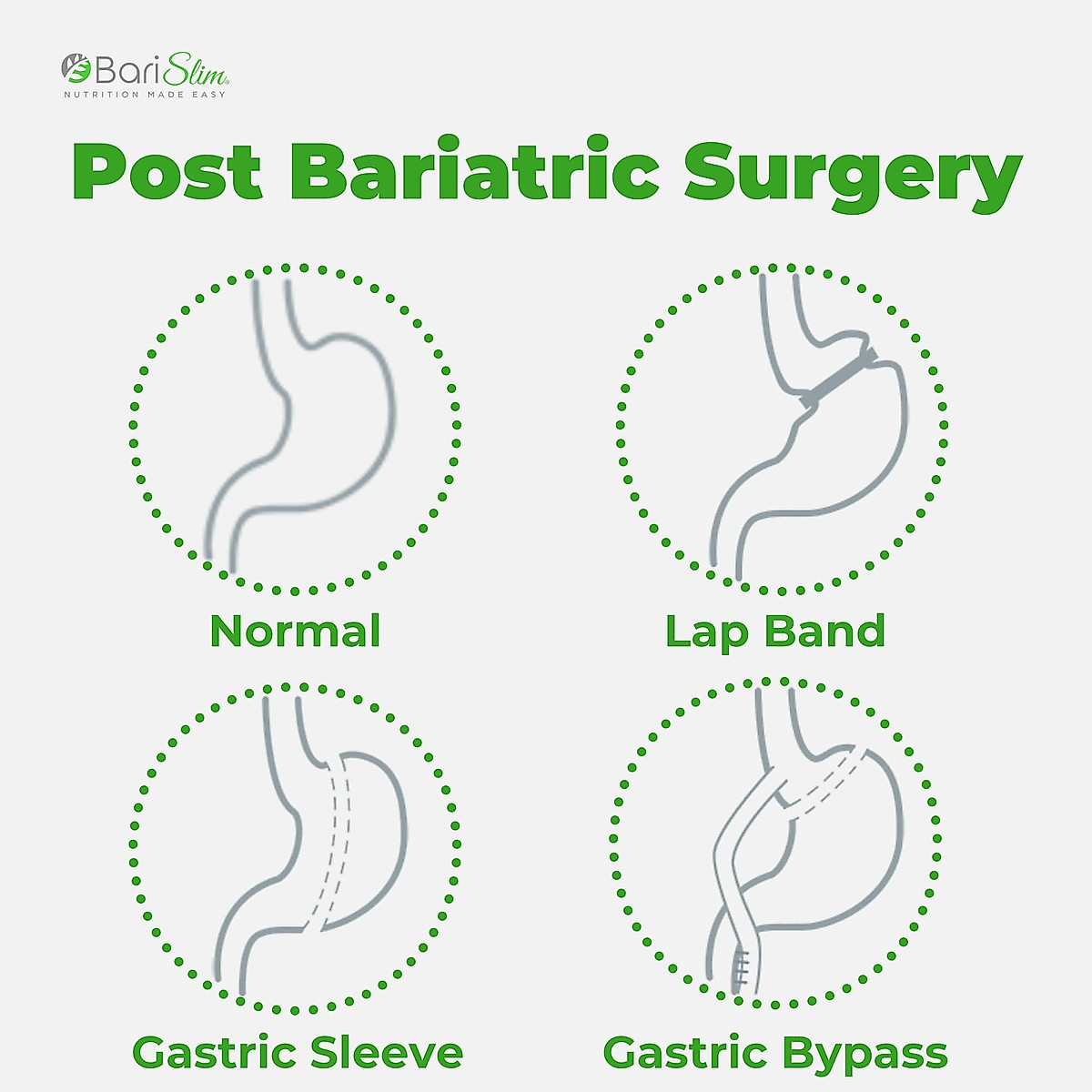 BariSlim Bariatric Calcium Citrate Plus Powder - Formulated for Patients After Weight Loss Surgery - Maximum Support for Bone Function and Health - Easy Digestion and Absorption | 600 mg (30 Servings)