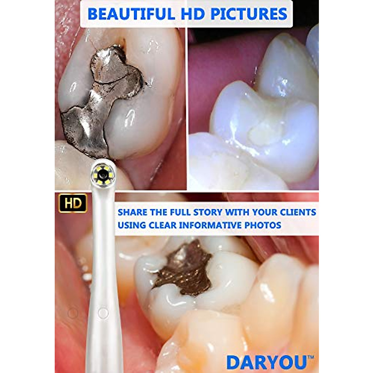 Intraoral Camera Dental Camera DARYOU DY-60 720P HD 4X Zoomable. Button Work w/Eaglesoft,Dexis,Carestream,Suni More