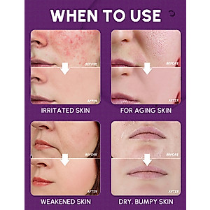 BANOBAGI Milk Thistle Repair Mask | Face Moisturizer Korean Face Mask Skin Care Sheet | Hydrating Face Masks Skincare Copper Tripeptide & Burdock Root Extract (Pack of 10 sheets, 1.01fl oz)