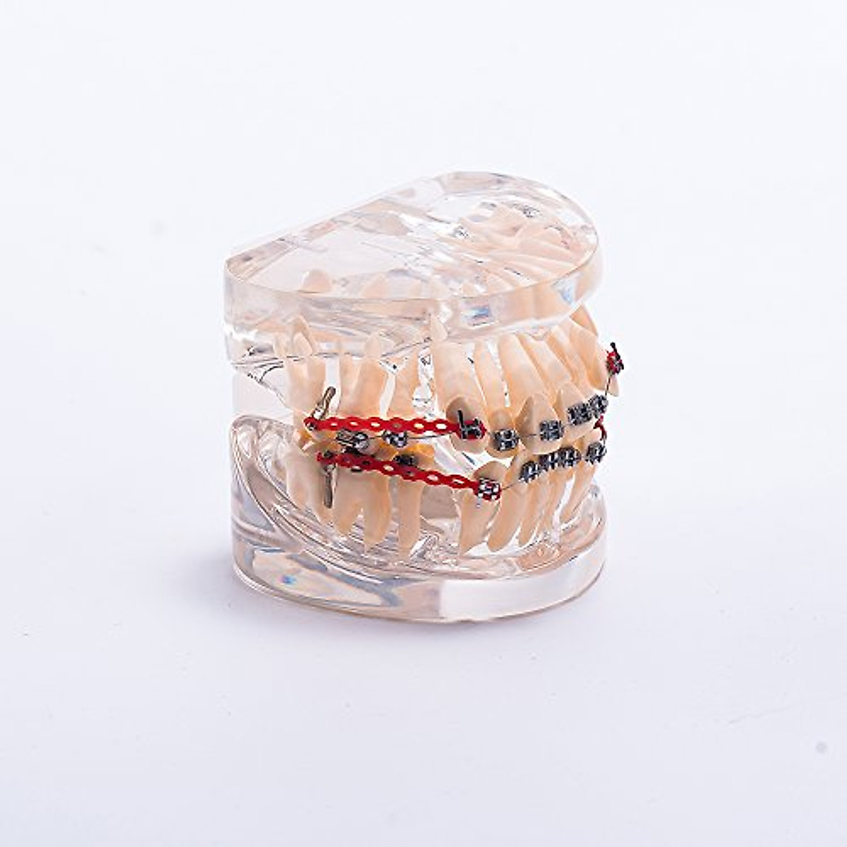 Easyinsmile Dental Orthodontic Treatment Model Teeth/Tooth/Denture Model with Braces for Dentist Studying Researching and Patient Education (Metal Bracket)