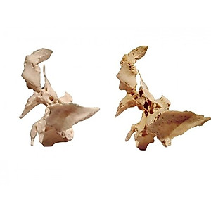 Wellden Medical Anatomical Adult Osteopathic Skull Model, 22-Part, Life Size, Bone Color