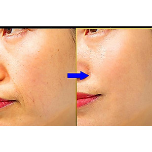 WHITESILK(𝟐𝟎𝟐𝟒 𝐔𝐩𝐠𝐫𝐚𝐝𝐞𝐝) Anti-Aging Skin Boosting SCM75 + HGF (Advanced +) Human Stem Cell 750,000ppm Super Ampoule, with SCM-3D Biomimetic Technology (10ml x 5 vials, 1.69oz)