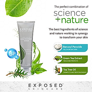 Exposed Skin Care Acne Treatment Serum Step 3 – Quickly Reduces Pimple Size and Redness - 12 Hour Spot Treatment - 3.5% Benzoyl Peroxide, Natural Green Tea & Tea Tree Oil