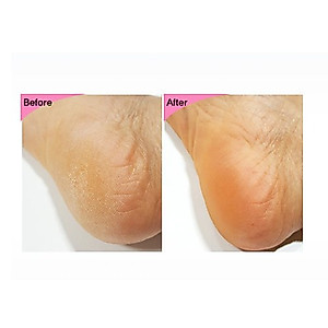 Essential Foot and Heel Peeling Mask Exfoliat Foot Peel - 2 Sheets