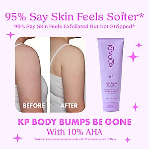 Kopari KP Body Bumps Be Gone Exfoliating Body Scrub with 10% AHA, to Smooth Skin, Reduce Bumps, Decongest Pores, Clarifying, Gently Exfoliate & Wash | 2 oz