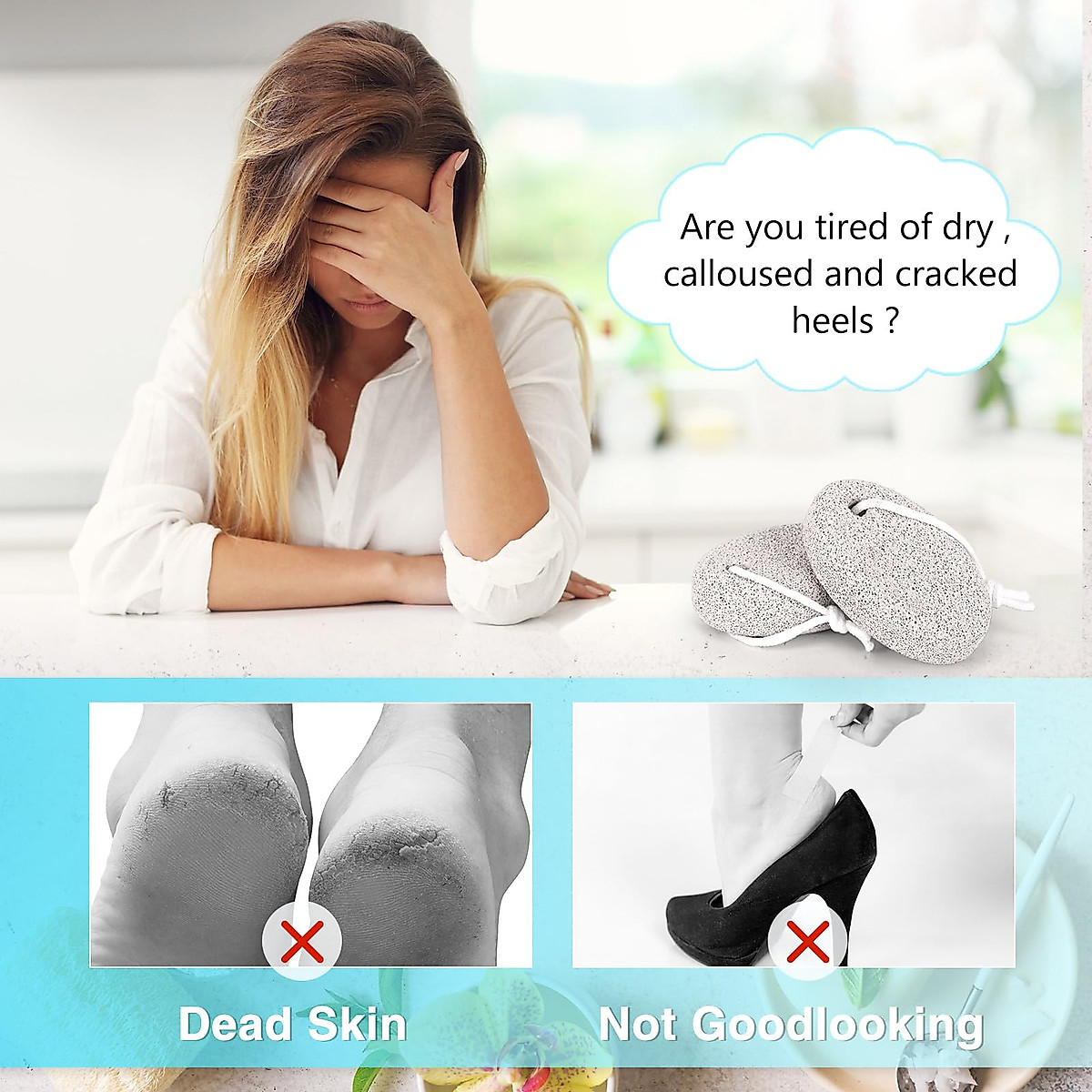 Umigy 20 Pack Natural Pumice Stone for Feet Lava Pedicure Tools Hard Skin Callus Remover for Men Women Feet and Hands Natural Foot File Exfoliation to Remove Dead Skin, Elbows (White)