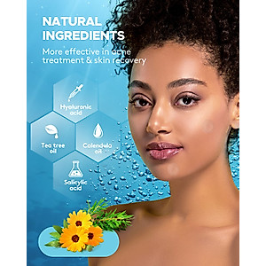 TKTK Self-Dissolving Microdart Acne Pimple Patches for Zits and Blemishes with 100% Pure Hyaluronic Acid, 4 Sizes Acne Absorbing Cover Patch, Acne Spot Treatment Stickers for Face and Skin (99 Count)