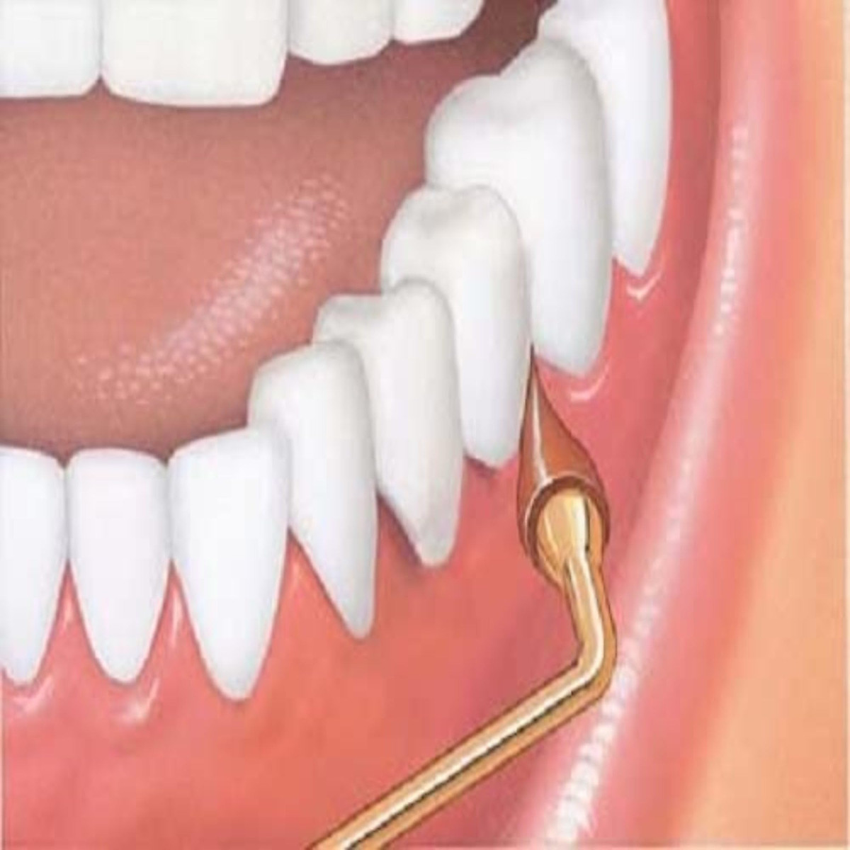 GUM Stimulator Refills - 3 Rubber Tips Included - Compatible with The Stimulator Permanent Handle - Massager, Plaque Removal Health,3ct, 1pk