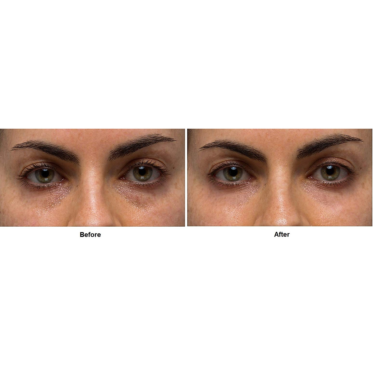 Dr. Dennis Gross Hyaluronic Marine™ Dew It Right™ Eye Gel: for Puffiness, Dark Circles, Dry, and Dehydrated Fine Lines, 0.5 fl oz