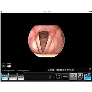 Vocal Parts, Pharynx & Larynx Anatomical Chart with Software Larynx and Vocal Fold ID Speech Language Pathology, SLP, Singing