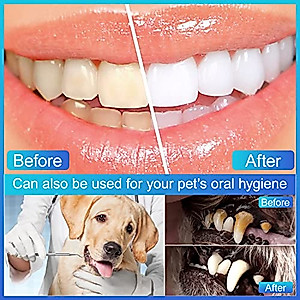 Dental Tools, Sopito 3PCS Teeth Cleaning Tools Stainless Steel Dental Scraper, Scaler Pick Plaque Remover Set