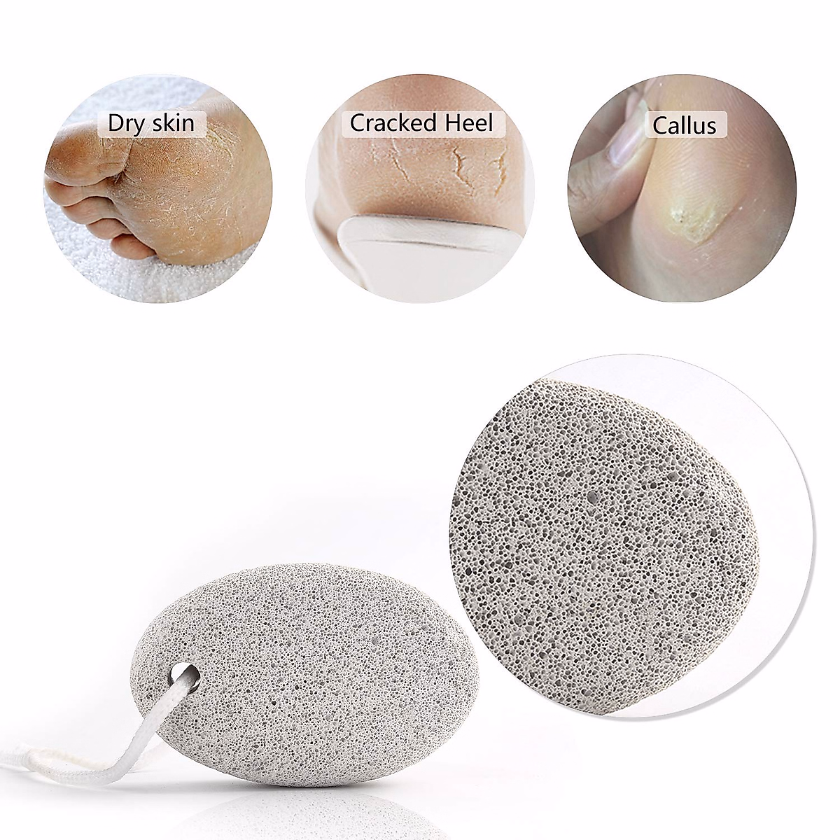 Natural Pumice Stone for Feet 2 PCS, PHOGARY Lava Pedicure Tools Hard Skin Callus Remover for Feet and Hands - Natural Foot File Exfoliation to Remove Dead Skin