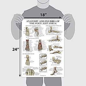 Palace Learning Laminated Anatomy and Injuries of the Foot and Ankle Poster - Anatomical Chart of Foot and Ankle Joint - 18" x 24"