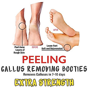 Onyx Professional Foot Peel Mask Callus Remover (2 Pack) Dead Skin Remover, Foot Exfoliator, Cracked Heel Repair - Feet Peeling Mask Pedicure Kit For Smooth Baby Soft Healthy Feet