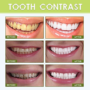 Teeth Whitening Strip, Professional Teeth Whitening Strips - Coconut Flavor, Fast Remove Smoking, Clean Yellow Teeth Stain, Reduced Sensitivity New Formula Oral Care Whitening Strips