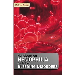 Handbook on hemophilia and other bleeding disorders