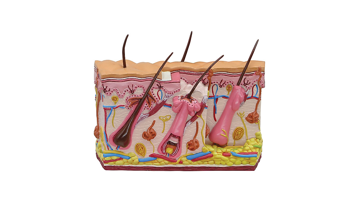 Skin Burn Model for Dermatology Education | GPI Anatomicals