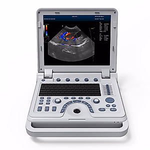 CONTEC Veterinary Ultrasound Scanner Color Doppler for Pregnancy in Animals Dogs Goats mare Horses Cattles with Tow probes convex and rectal linear probe