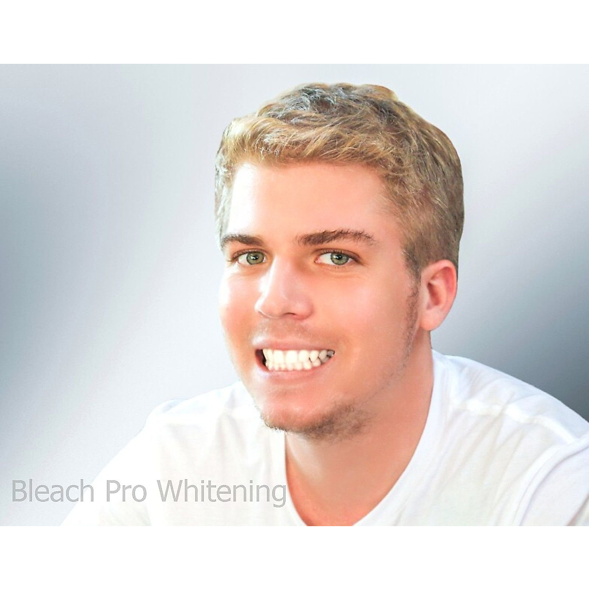 Teeth Whitening Gel Syringe Dispensers 22% Carbamide Peroxide, 10 Tooth Bleaching Gel 3ml Syringes