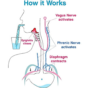 HiccAway Hiccup Straw - Stops Hiccups Naturally & Fast - As Seen On Shark Tank - Clinically Proven Relief for All Ages, Children & Adults - Safe, Lightweight, & Reusable (HiccAway Blue) 1 Pack