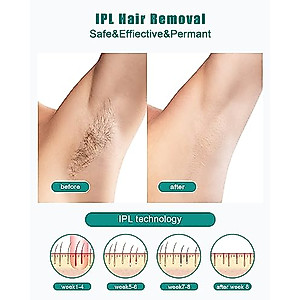 Laser Hair Removal with Cooling System, Permanent Hair Removal Device for Women and Men, Painless At-Home IPL Hair Removal for Facial Legs Arms Bikini Line Whole Body