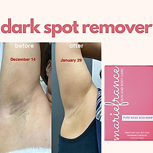 Pure Kojic Acid Soap for Hyperpigmentation, Dark Spots & Skin Brightening with Papaya Extract, Vitamin C & E - Maximum Strength, Fragrance-free, 5.3 oz