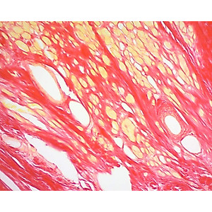 Picrosirius Red Stain Pack (for Collagen), 250ml