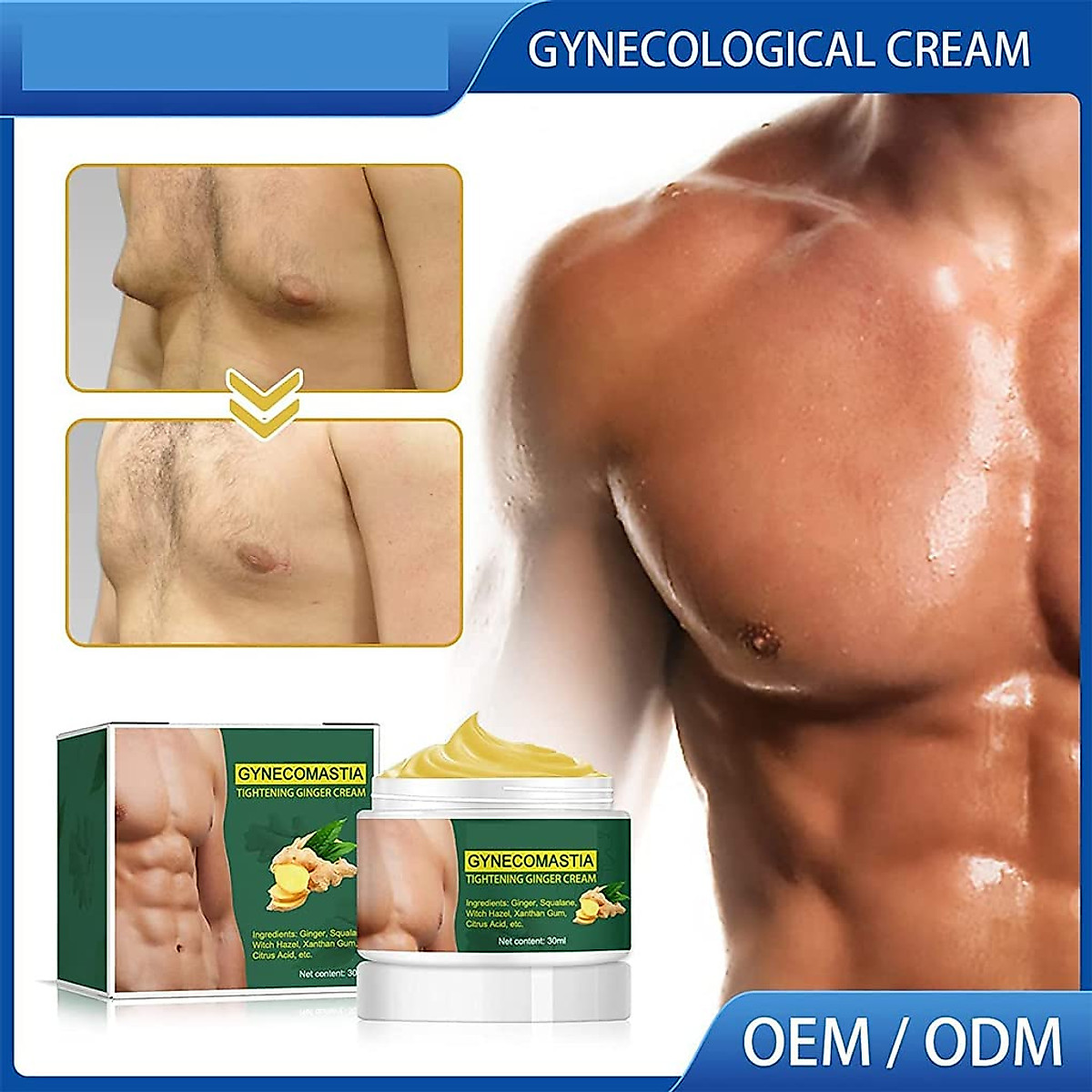 YCSM SoliPac Ginger Cream, Solipac Gynecomastia Tightening Ginger Cream,30 ml Ginger Fat Burning Cream Weight Loss Anti-Cellulite Slimming Cream for Men(2PCS)