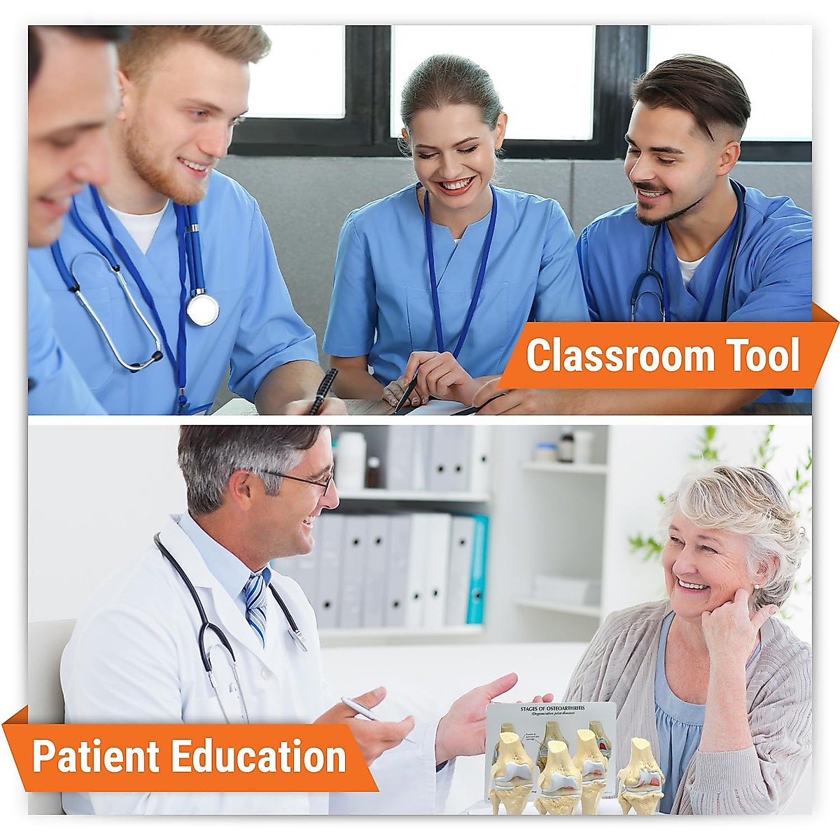 GPI Anatomicals Knee Joint Model Set | Human Body Anatomy Replica Set of 4-Stage Osteoarthritis Knee Joint for Doctors Office Educational Tool