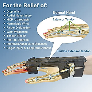Feamero Radial Nerve Palsy Splint, Adjustable Finger Lift Elastic Strap Arm Brace Splint for Drop Wrist, Radial Nerve Injury, Mcp Arthroplasty, Finger Injury Arthritis, Unisex Fit Left & Right Hand