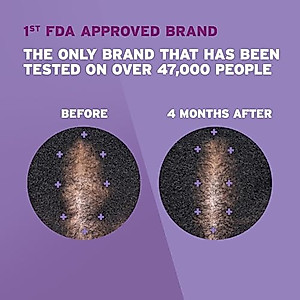 Rogaine 5% Minoxidil Foam, Topical Once-A-Day Hair Loss Treatment for Women to Regrow Fuller, Thicker Hair, Unscented, 2-Month Supply, 2.11 oz