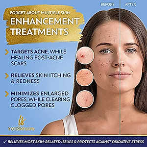 DOUBLE SIZED (2Oz) Niacinamide Serum for Face 10% with Zinc 1% Vitamin B3 Facial Serum Brightening Serum for Acne Pore Minimizer and Dark Spot Remover