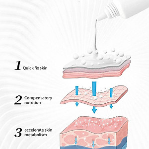 Acne Cream Pimple Cream for Face, Oil Control Pimple Remover Cream Get Rid of Pimples Fast,for Oily and Acne Prone Skin, Cruelty Free, Crema para espinillas en la cara