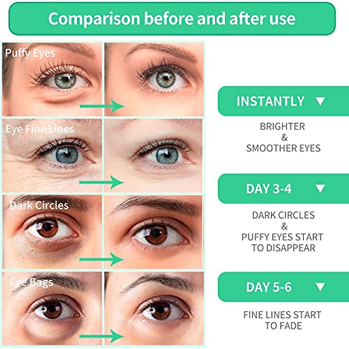 BREYLEE Aloe Vera Eye Mask– 60 Pcs - Puffy Eyes and Dark Circles Treatments – Look Younger and Reduce Wrinkles and Fine Lines Undereye, Improve and Firm eye Skin - Pure Natural Material Extraction