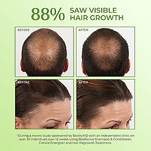 BosleyMD Follicle Energizer Foil 3 ml, 0.1 fl oz