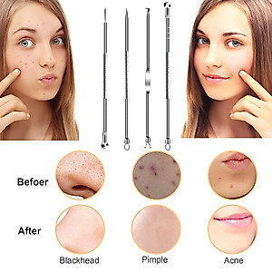 Blackhead Removal Tools, 4 Pcs Pimple Popper Tool Kit, Professional Stainless Pimples Comedone Extractor with Portable Case(Silver)