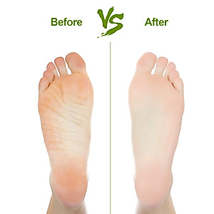 2PCS Natural Pumice Stone, Asqraqo Lava Pedicure Tools Hard Skin Callus Remover for Feet and Hands - Foot File Exfoliation to Remove Dead Skin, and Callusess