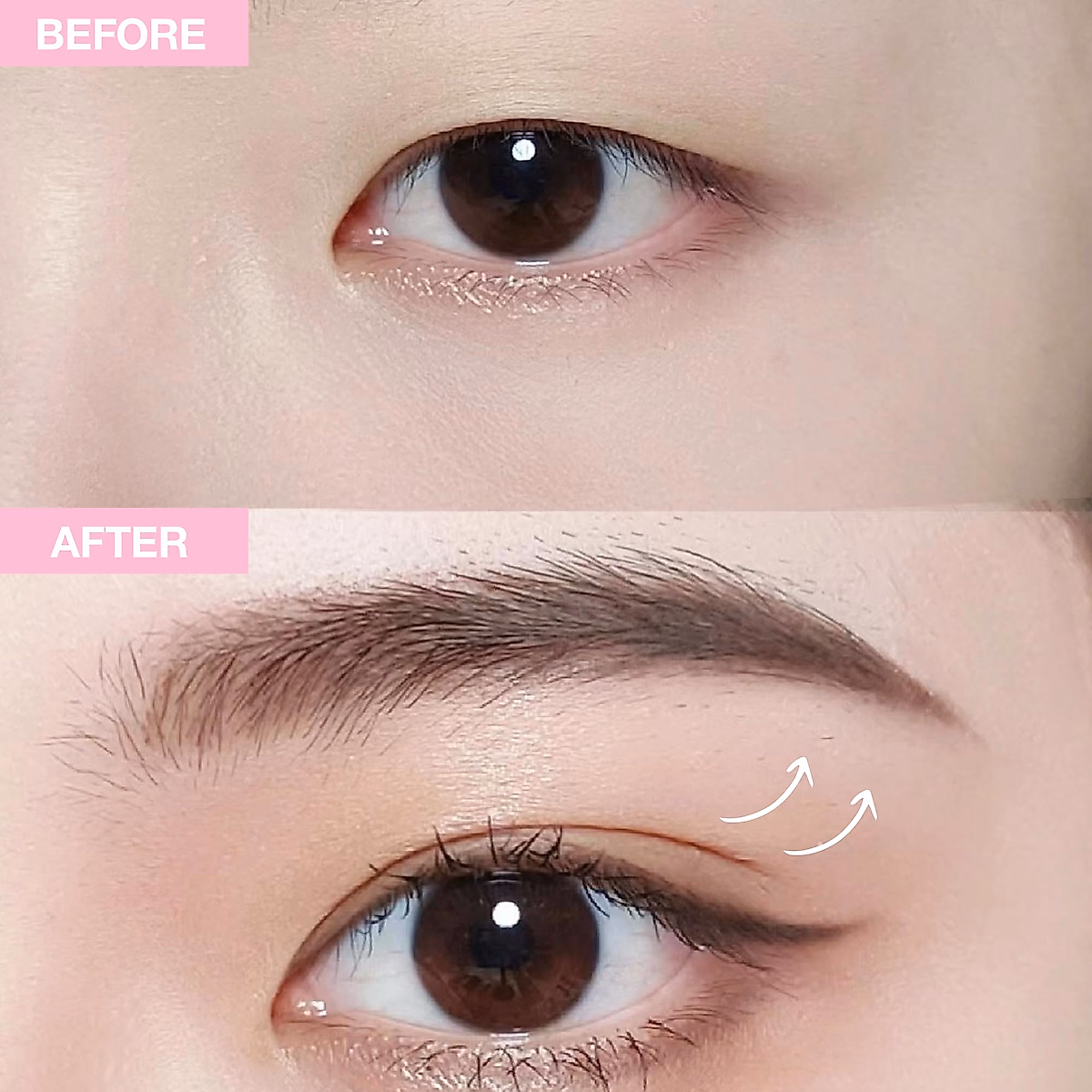 Beauty Logic Aqua Lace Eyelid Lifting Kit, 120 Invisible Lifter Tape Strips, Instant Natural Self Adhesive Upper Eye Lid Lift Double Stickers for Hooded Droopy Puffy Uneven Eyes (Medium)