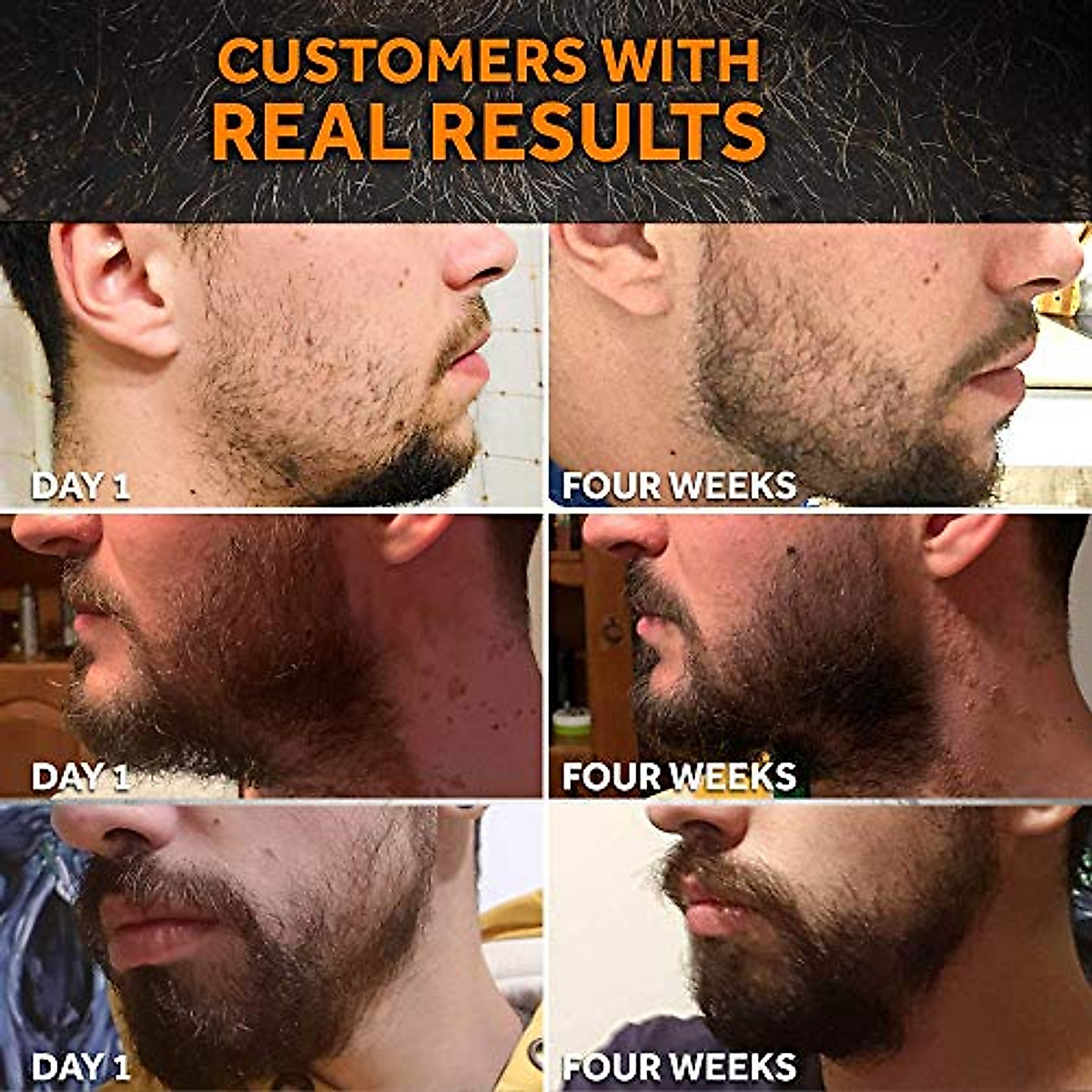 FOLLICLE BOOSTER Complete Beard Growth Kit - 6 in 1 - Coverup Your Patchy Beard in 12 Weeks - Roller, Serum Oil (1oz), Balm (1oz), Wash Soap, Cleanser and Comb