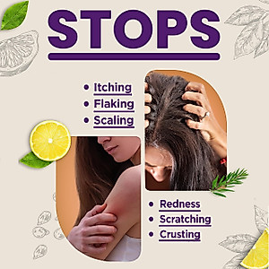 Candida Freedom Massey's CF 100% Natural Probiotic Soap Bar - Elevate Your Skincare Routine with Potent Tea Tree and Refreshing Lemon Essence - Pure Citrus Bliss 4oz