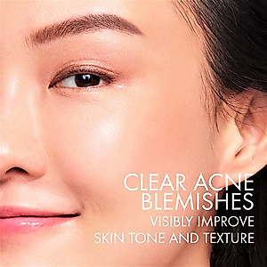 Vichy Normaderm Acne Control Daily Moisturizer, Acne Moisturizer For Face, 2% Salicylic Acid + Hyaluronic Acid + Vitamin C, Acne Treatment For Blackheads, Acne Blemishes & Enlarged Pores, Oil Free