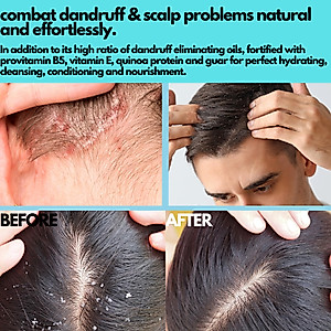 Kirei SHIBUMI Anti-Dandruff 2in1 Shampoo & Conditioner Bar for Oily&Dry Flaky Scalp Nourishing Treatment Solid Shampoo Bar