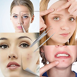 FIXBODY Blackhead and Splinter Remover Tools - Stainless Steel Professional Easily Cure Pimples Whiteheads Comedones Acne Zit Ingrown Hairs and Facial Impurities Bend Head Tweezer Surgical Kit