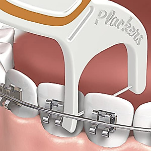 Plackers Orthopick Dental Floss Picks for Braces, 144 Count (36 pack of 4) Made with Super TufFloss, Soft, Flexible Toothpick, Gentle on Braces, Orange