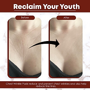 Klara Faire Chest wrinkle pads 4 pack | Decollete anti wrinkle chest pads | Chest Wrinkle Pads Sleeping | Anti wrinkle Chest pads | Washable Chest Wrinkle Prevention