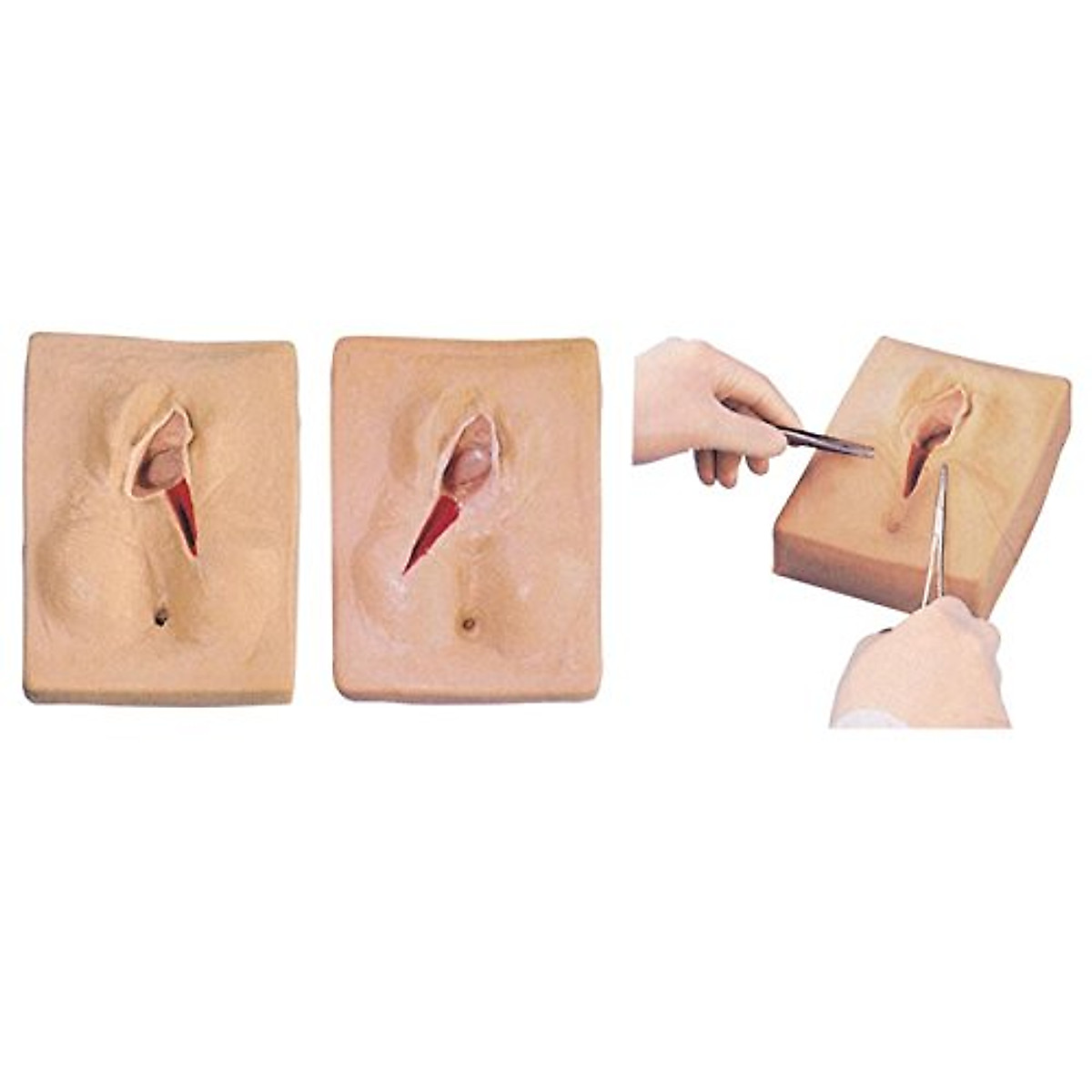 Vulva lateral Perineal Laceration/Episiotomy Suture Simulator Suturing Training Model(Right, Left or Median posterior Incision can be Selected)