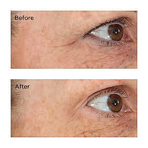 Essential Fx Acyl-Glutathione Eyelid Lift Serum, 0.5 fl. oz.