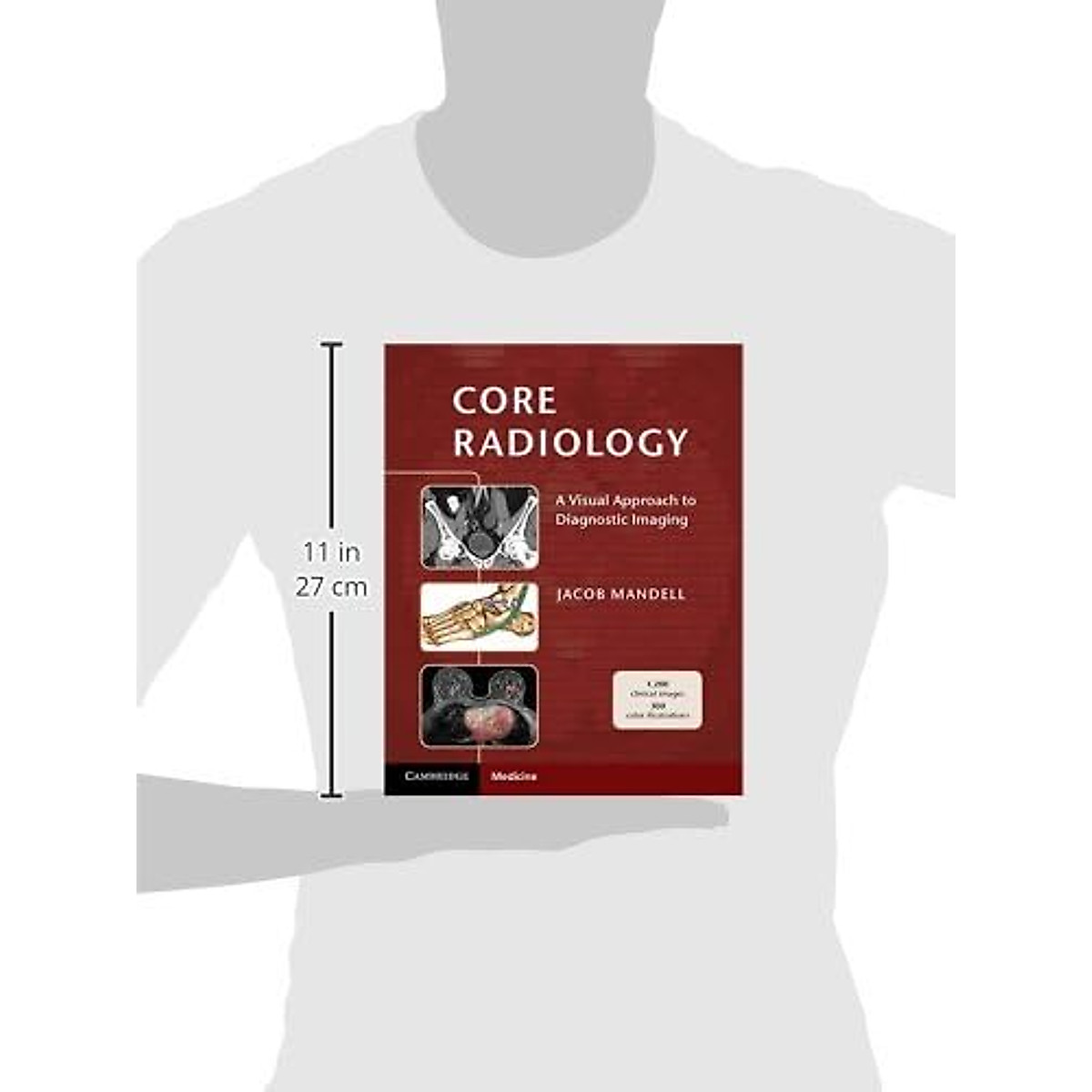 Core Radiology: A Visual Approach to Diagnostic Imaging
