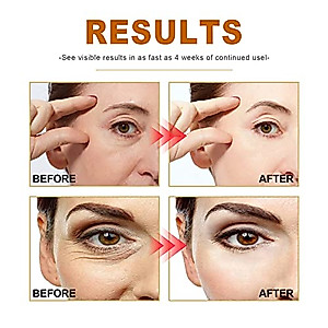 Jonela Beauty Universal Glow Serum, 30ml Pedia Advanced Collagen Boost Anti Aging Serum, Skin Glow Serum, Face Serum Lifting Firm Advanced Deep Anti Wrinkle-Serums, Lighten Spots (2pcs)