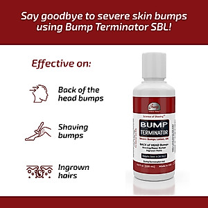 Bump Terminator Severe Bumps Lotion (4oz)